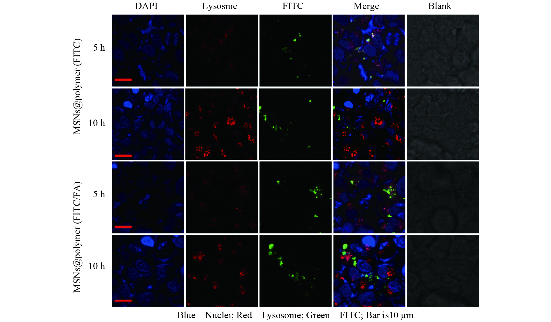 pH响应MSNs@polymer（FITC/FA）核-壳结构双重药物载体