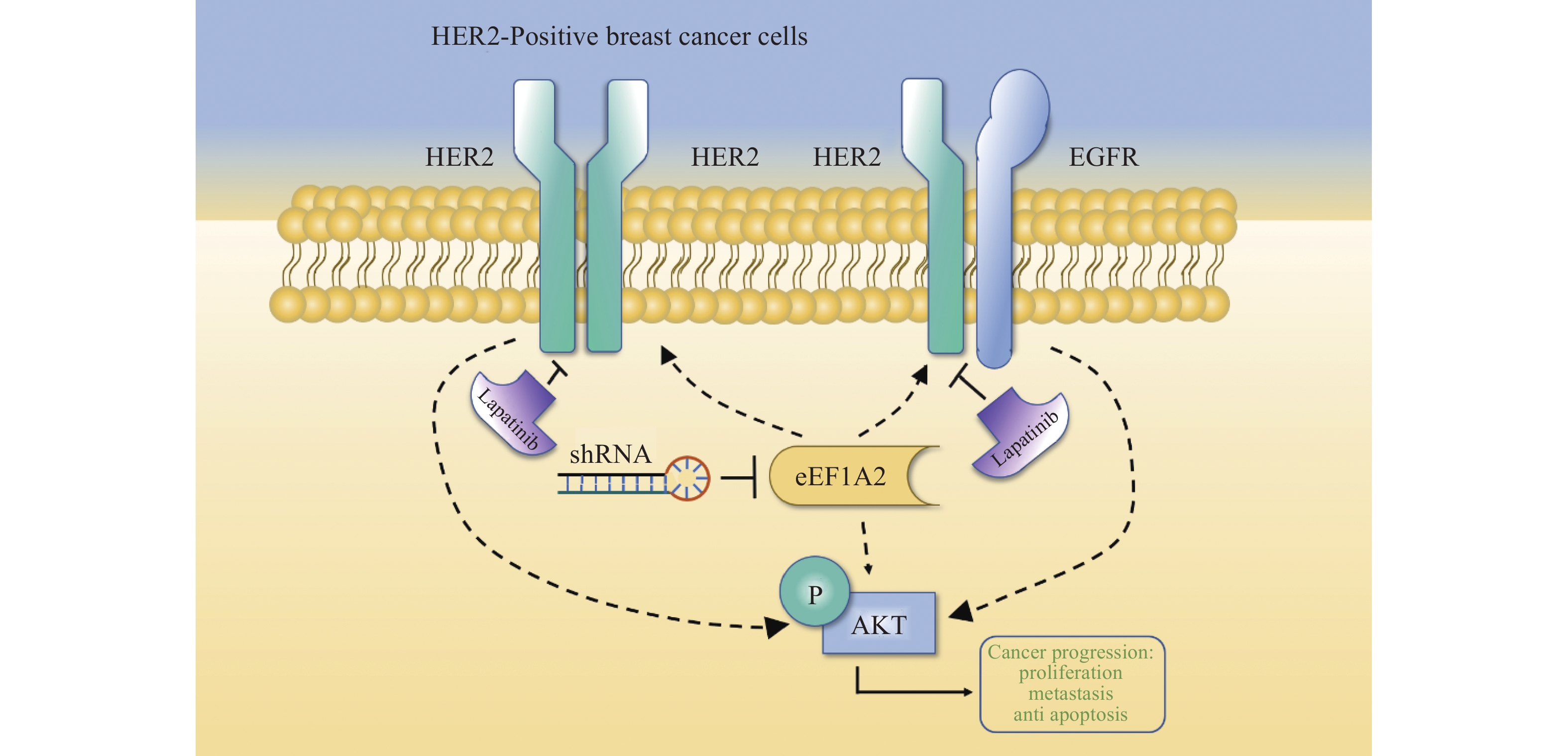 Knockdown of EEF1A2 Enhanced the Efficacy of Lapatinib on HER2+ Breast ...